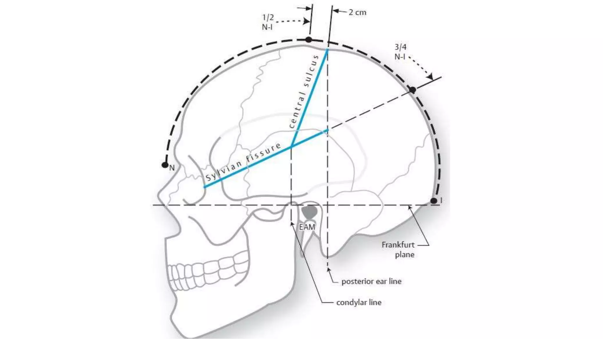 Surgical landmarks and sectional anatomy in neurosurgery | PPTX