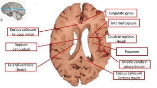 Surgical landmarks and sectional anatomy in neurosurgery | PPTX