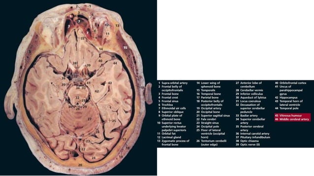 Surgical landmarks and sectional anatomy in neurosurgery | PPT