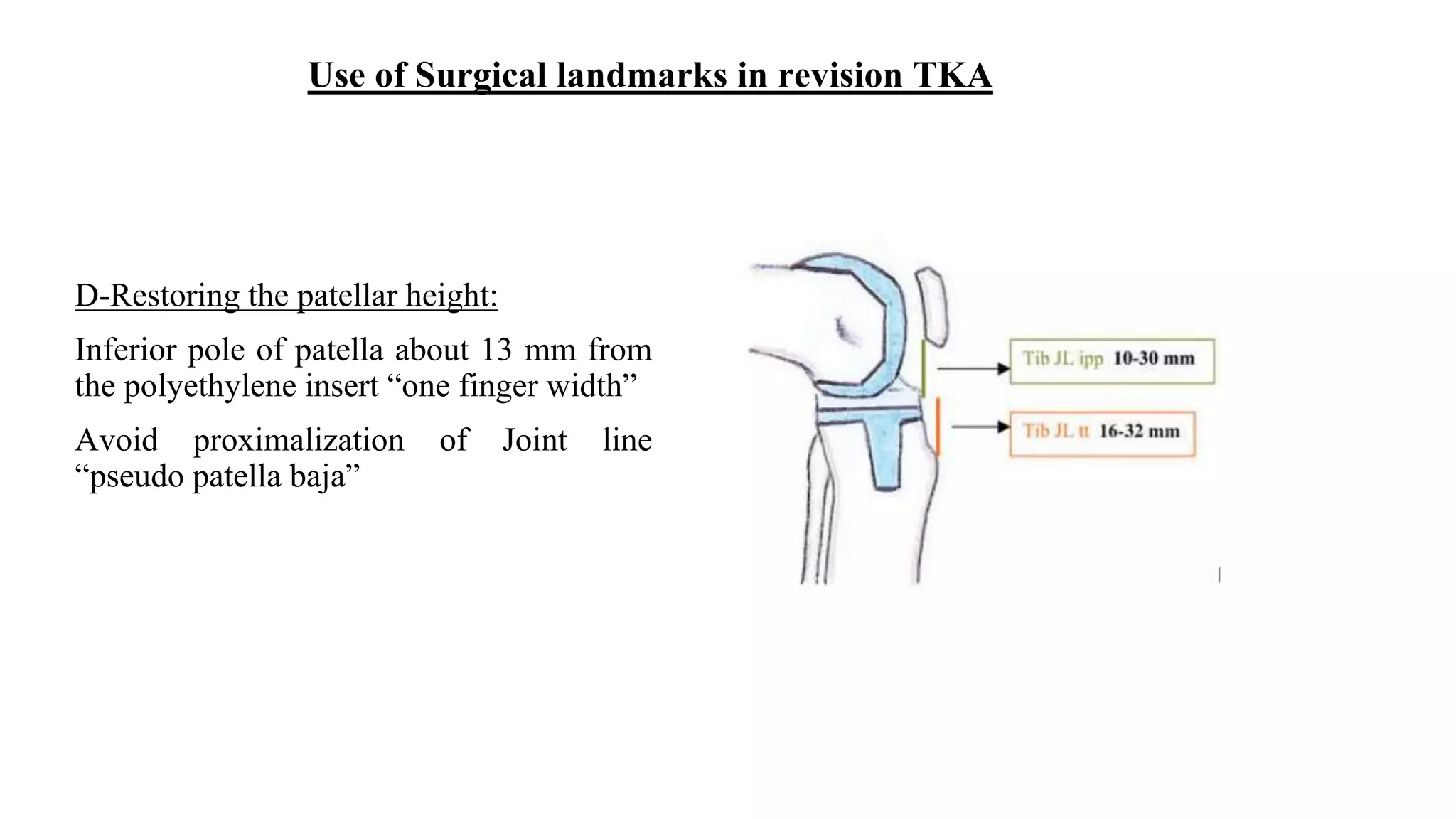 Surgical landmarks in revision total knee | PPTX