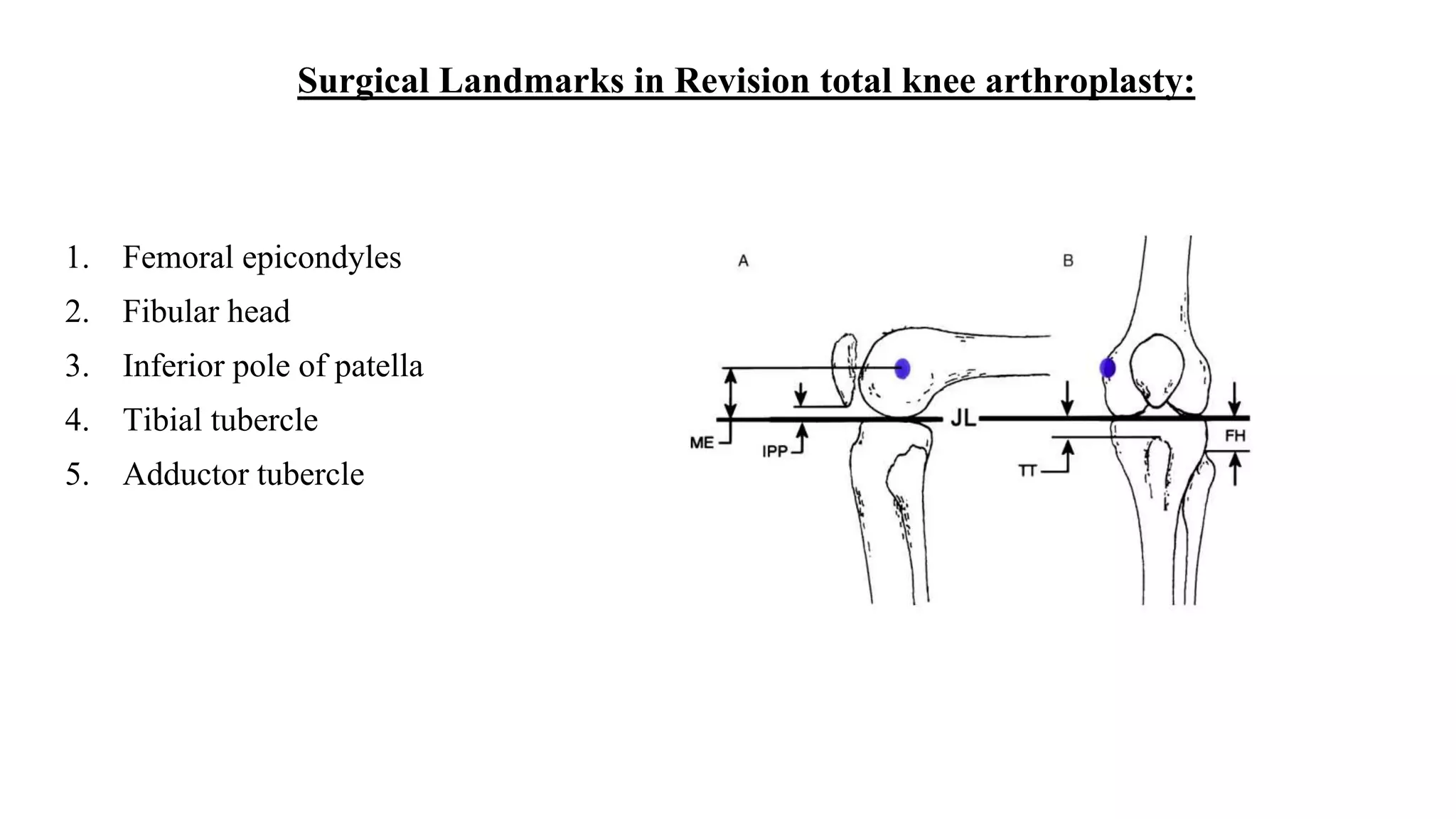 Surgical landmarks in revision total knee | PPT