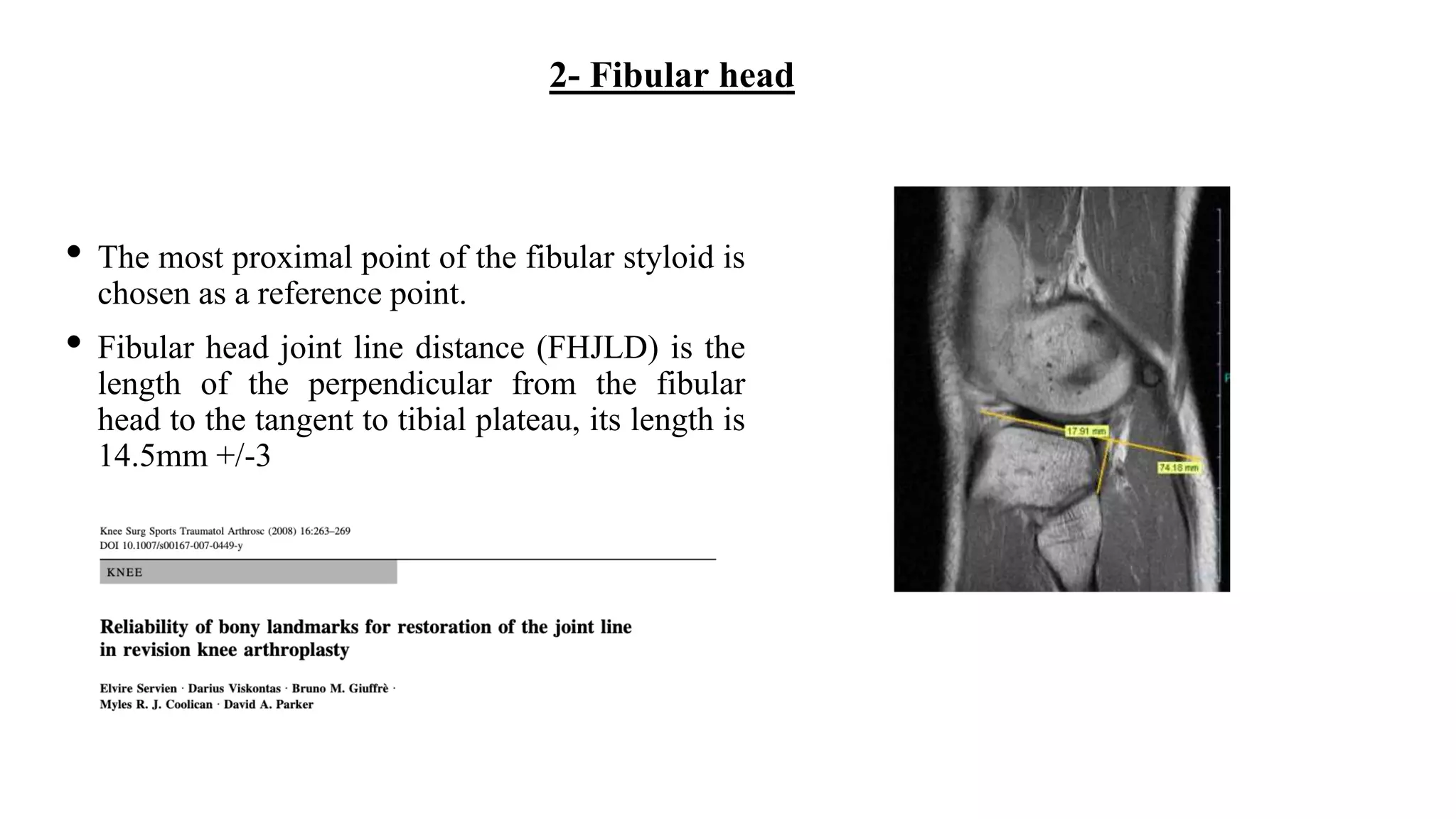 Surgical landmarks in revision total knee | PPT