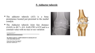 Surgical landmarks in revision total knee | PPTX