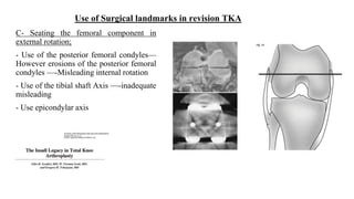 Surgical landmarks in revision total knee | PPT