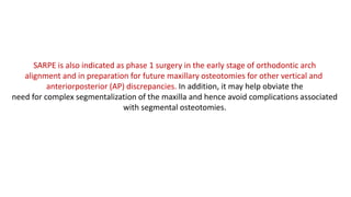 Surgically Assisted Rapid Palatal Expansion (SARPE) | PPTX
