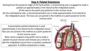 Surgically Assisted Rapid Palatal Expansion (SARPE) | PPT