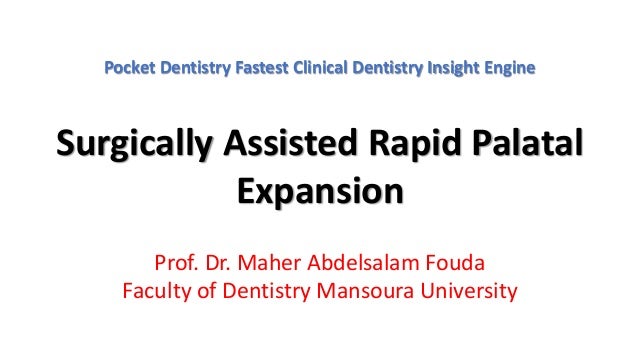 Surgically Assisted Rapid Palatal Expansion (SARPE)