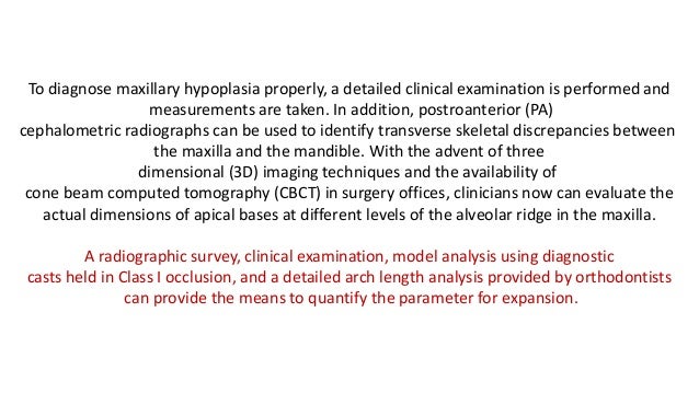 Surgically Assisted Rapid Palatal Expansion (SARPE)