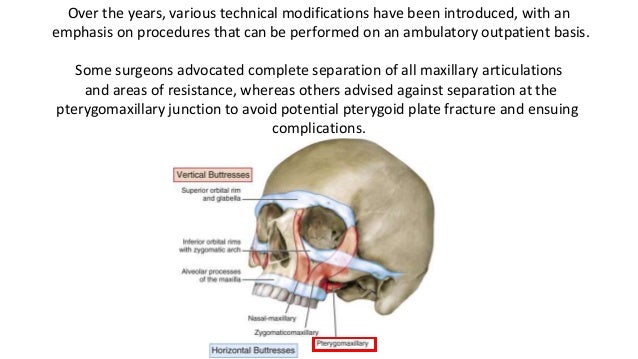 Surgically Assisted Rapid Palatal Expansion (SARPE)