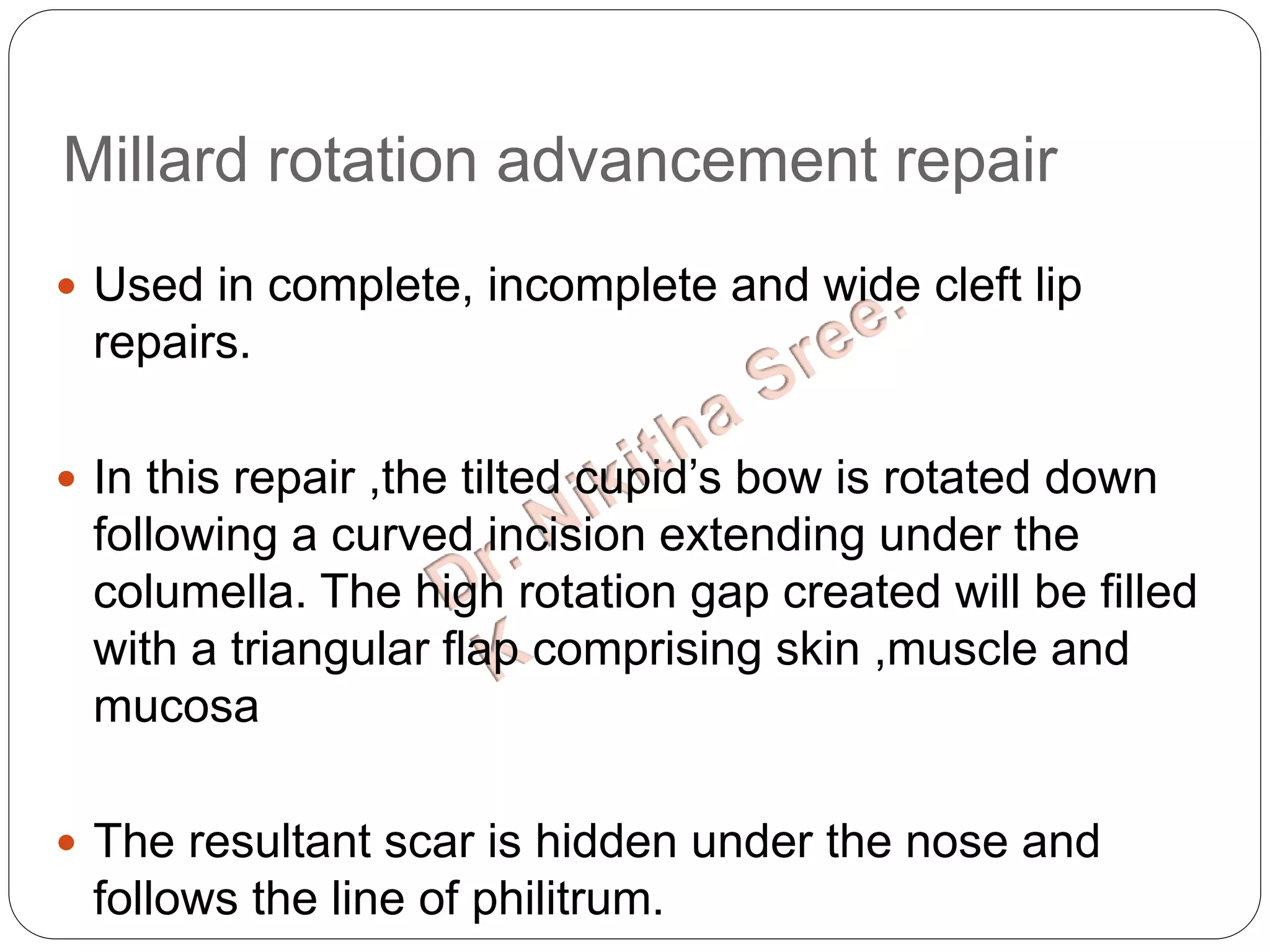 Surgical management cleft lip and palate | PPTX