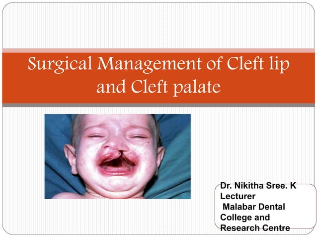 Surgical management cleft lip and palate | PPTX | Ear, Nose and Throat Conditions | Diseases and ...
