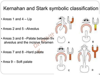 Surgical management cleft lip and palate | PPTX