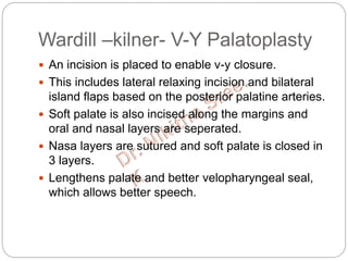 Surgical management cleft lip and palate | PPTX