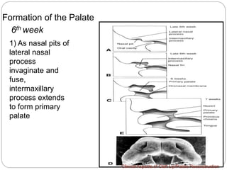 Surgical management cleft lip and palate | PPTX