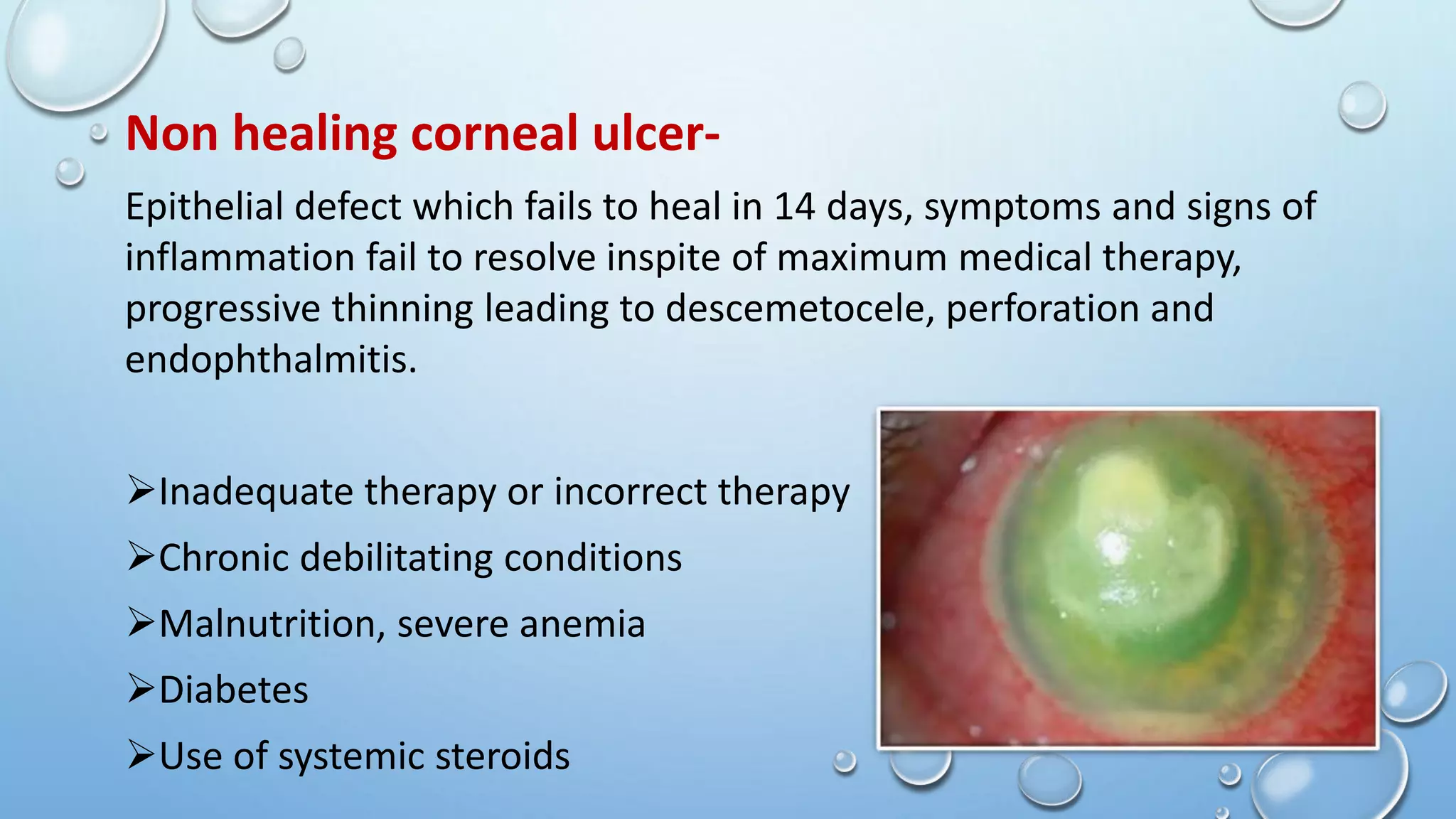 Surgical management of corneal ulcer | PPTX