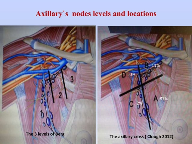 4 ΟΓΚΟΛΟΓΙΚΟ ΣΥΝΕΔΡΙΟ ΡΟΔΟΥ: Surgical management axilla. | PPT