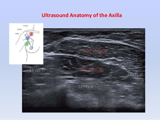 4 ΟΓΚΟΛΟΓΙΚΟ ΣΥΝΕΔΡΙΟ ΡΟΔΟΥ: Surgical management axilla.