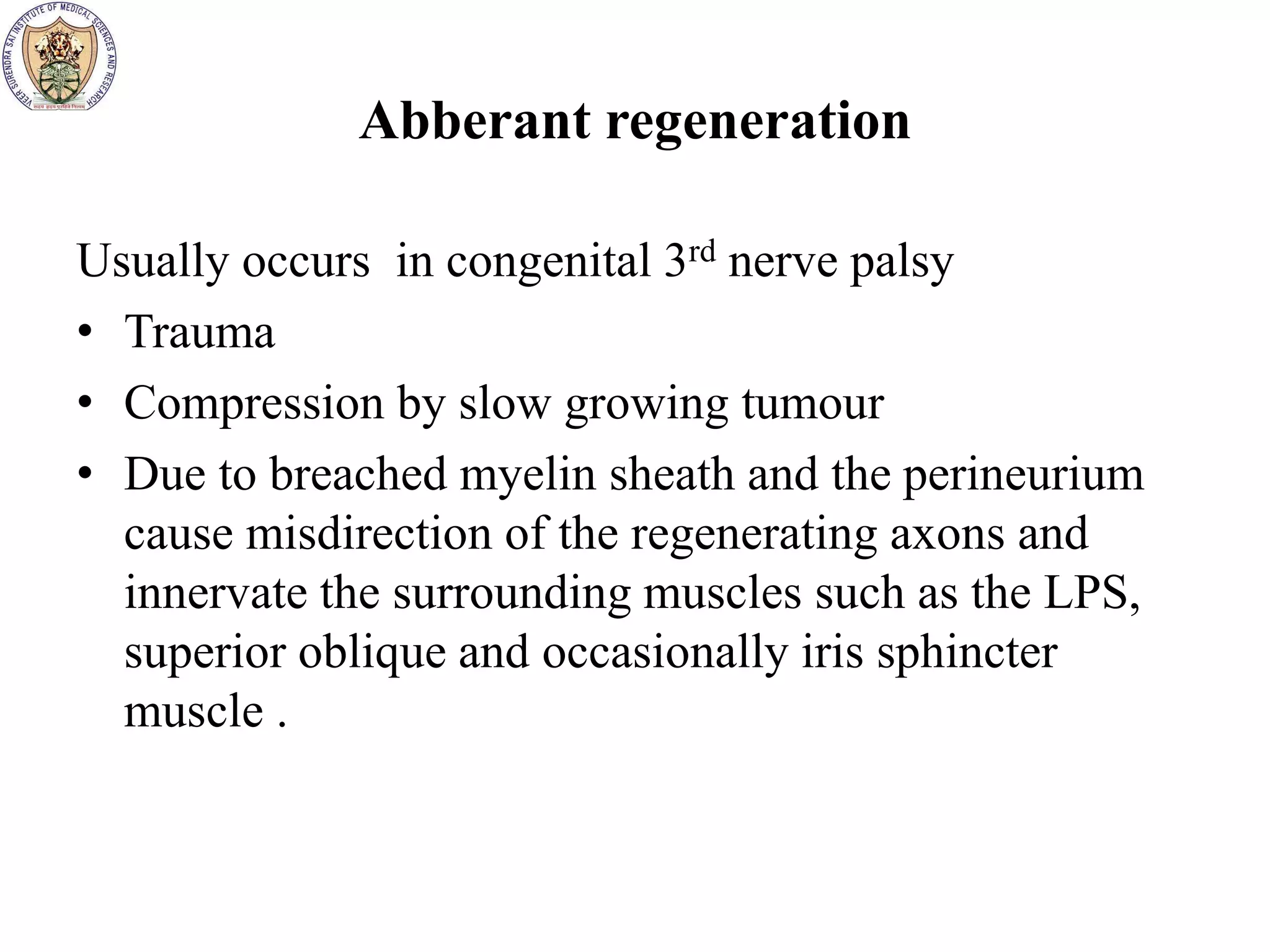 Surgical management in 3rd nerve palsy | PPTX
