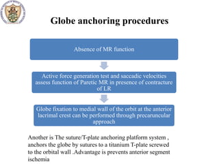Surgical management in 3rd nerve palsy | PPTX