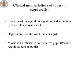 Surgical management in 3rd nerve palsy | PPTX