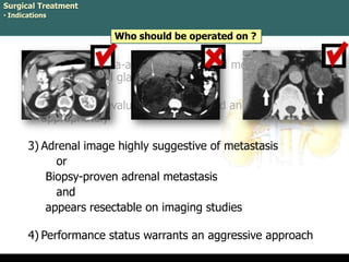 Surgical management of adrenal mets third part | PPTX