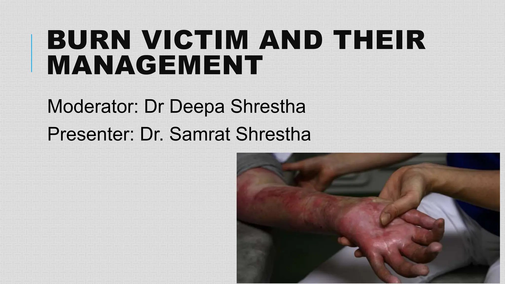 SURGICAL MANAGEMENTOF BURN patient VICTIM.pptx