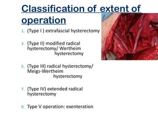 Surgical management of carcinoma cervix | PPT