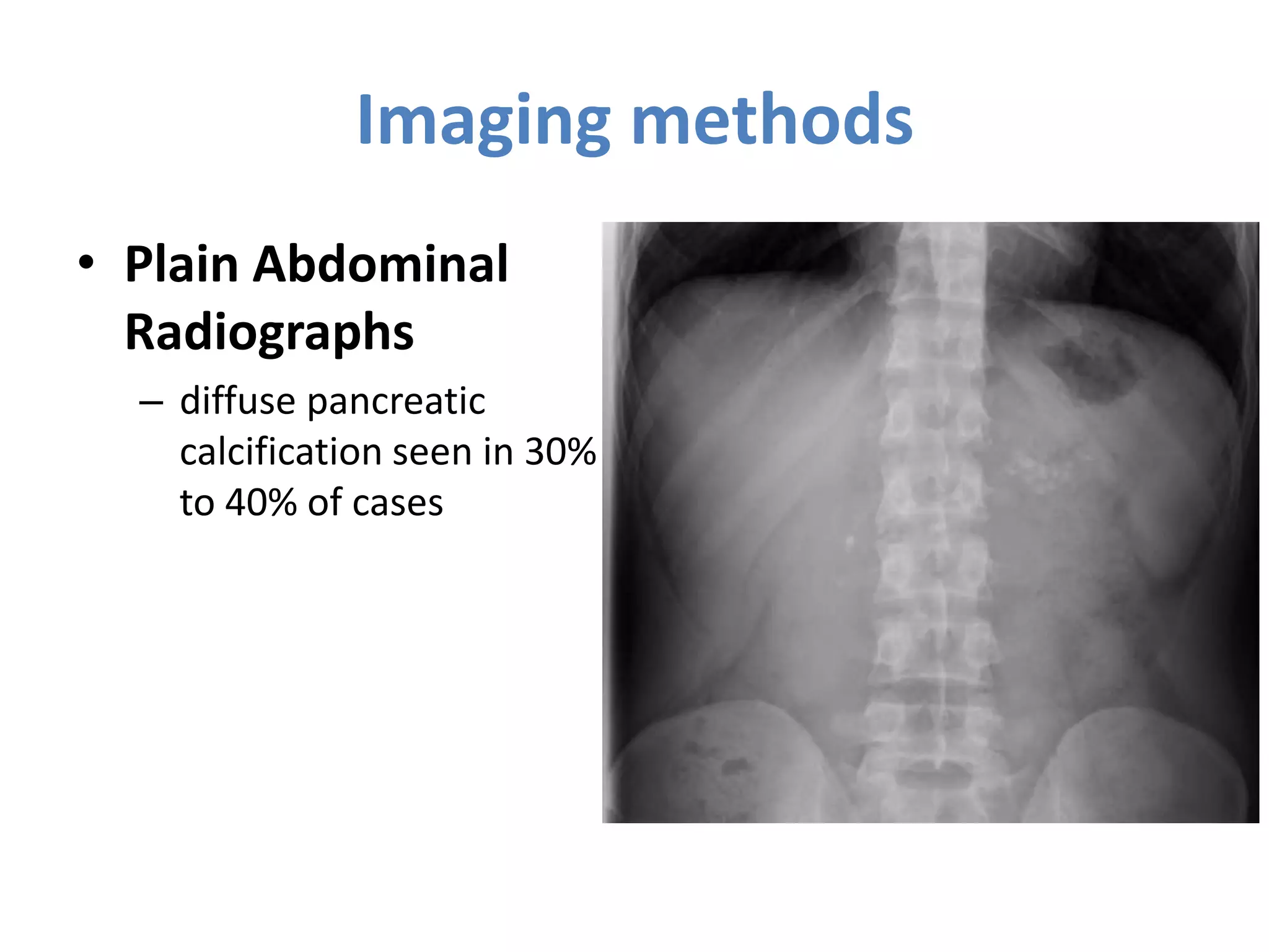 Surgical management of chronic pancreatitis. | PPTX