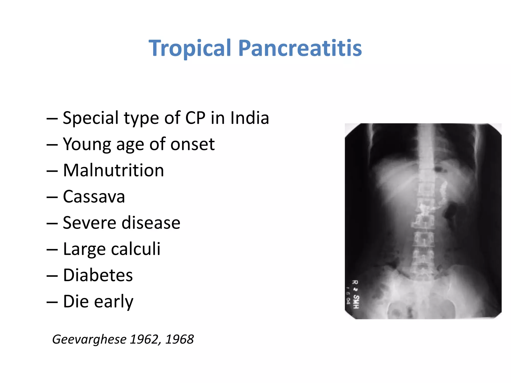 Surgical management of chronic pancreatitis. | PPTX
