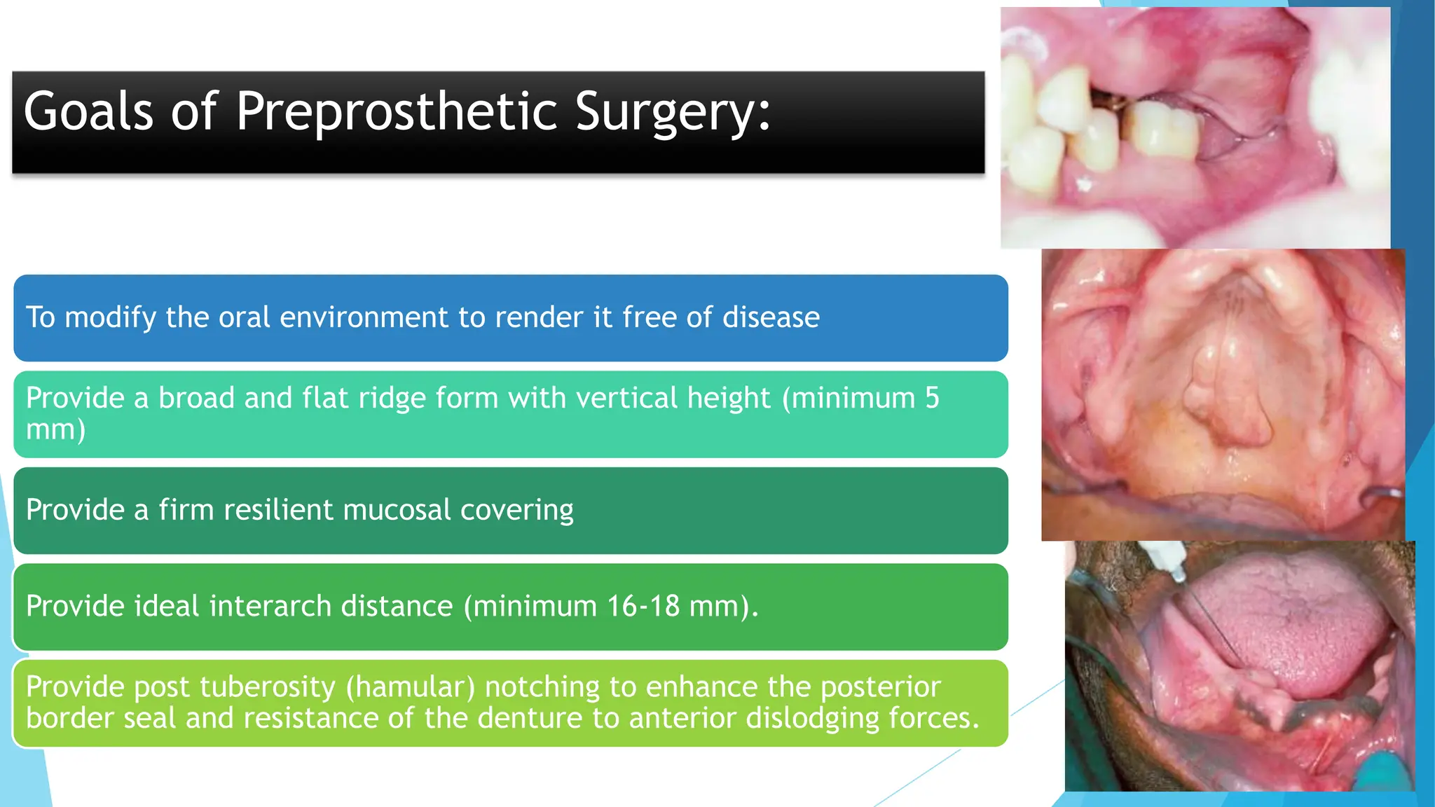 SURGICAL MANAGEMENT OF COMPLETE DENTURE PATIENT | PPTX