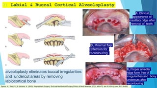 SURGICAL MANAGEMENT OF COMPLETE DENTURE PATIENT | PPTX
