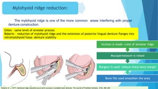 SURGICAL MANAGEMENT OF COMPLETE DENTURE PATIENT | PPTX