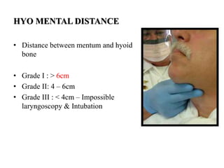 Surgical management of difficult adult airway by Dr.Ashwin Menon | PPTX