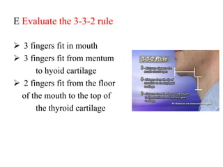Surgical management of difficult adult airway by Dr.Ashwin Menon | PPTX