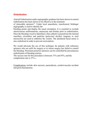 Surgical management of epistaxix | DOCX