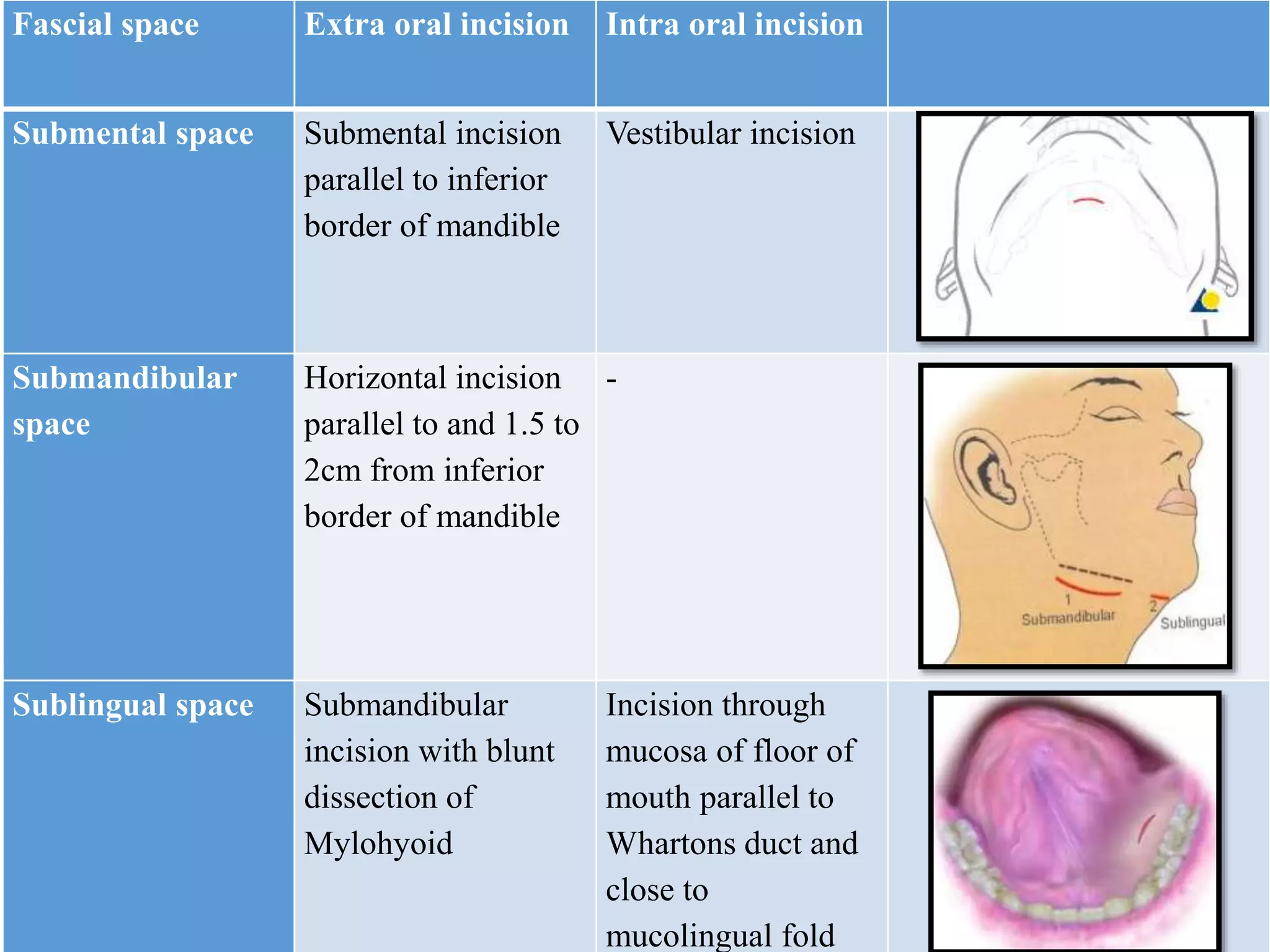SURGICAL MANAGEMENT OF FASCIAL SPACE INFECTIONS.pptx