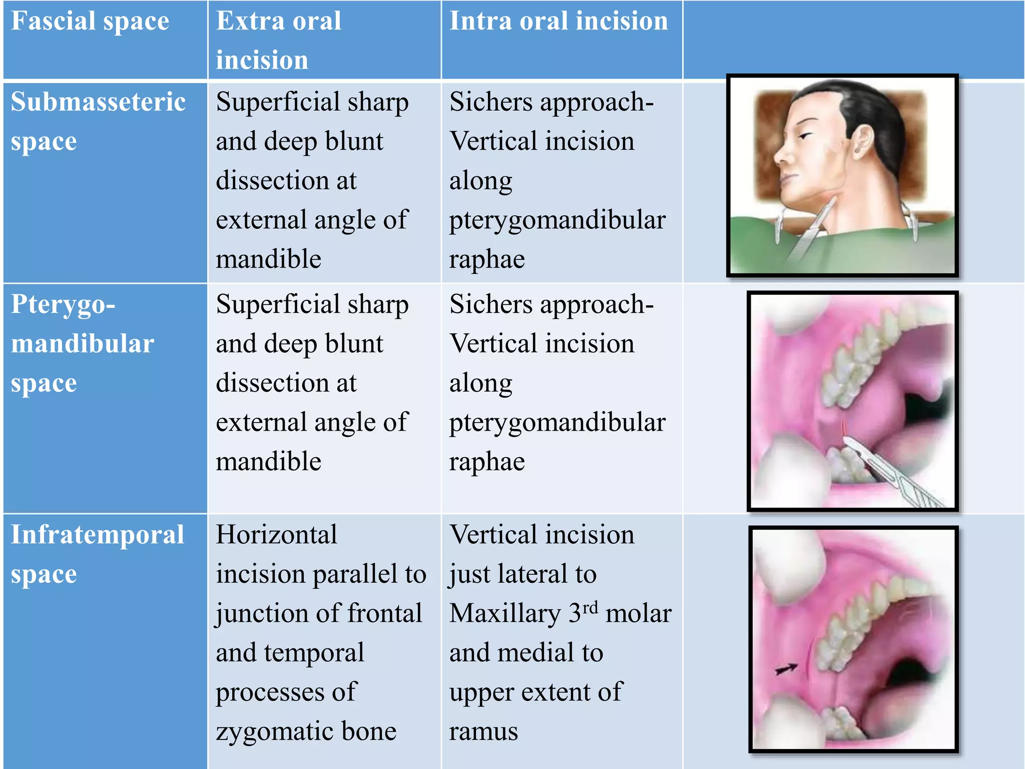 SURGICAL MANAGEMENT OF FASCIAL SPACE INFECTIONS.pptx