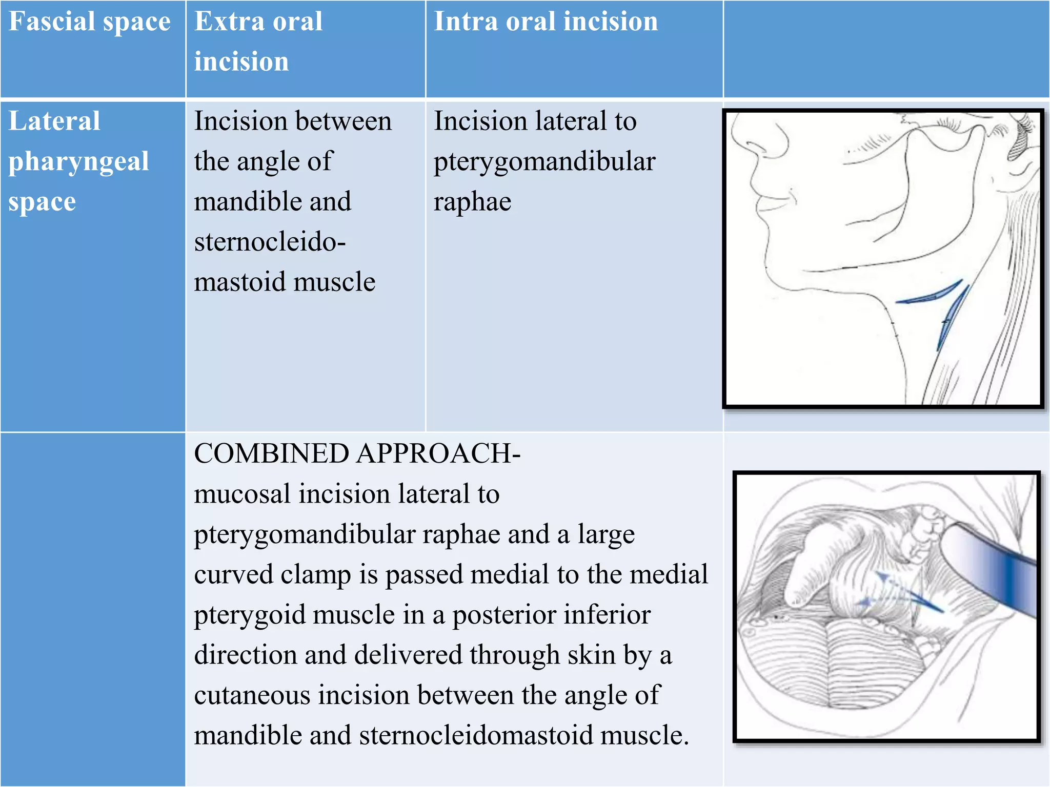 SURGICAL MANAGEMENT OF FASCIAL SPACE INFECTIONS.pptx