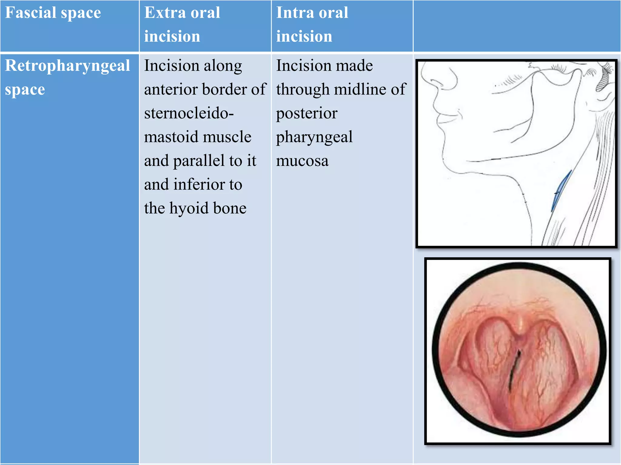 SURGICAL MANAGEMENT OF FASCIAL SPACE INFECTIONS.pptx