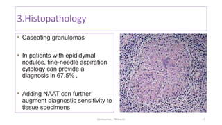 Surgical management of Genitourinary TB.pptx
