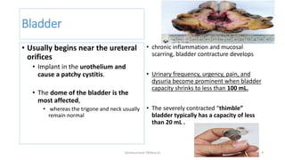 Surgical management of Genitourinary TB.pptx
