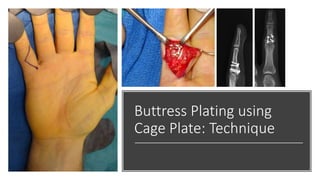 Surgical management of hand, wrist and elbow injuries | PPTX