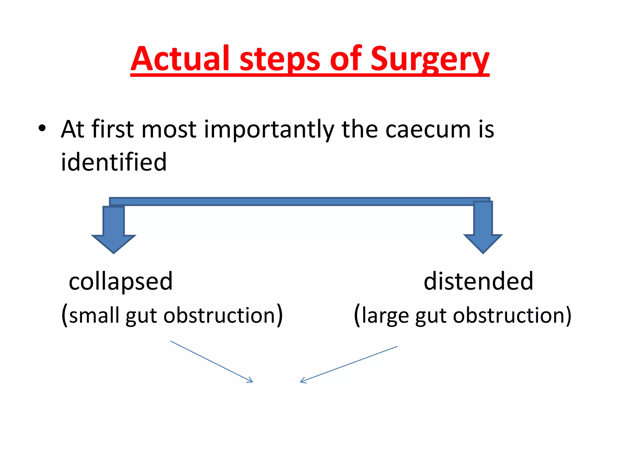 Surgical management of intestinal obstruction Shinjan Patra Medical ...