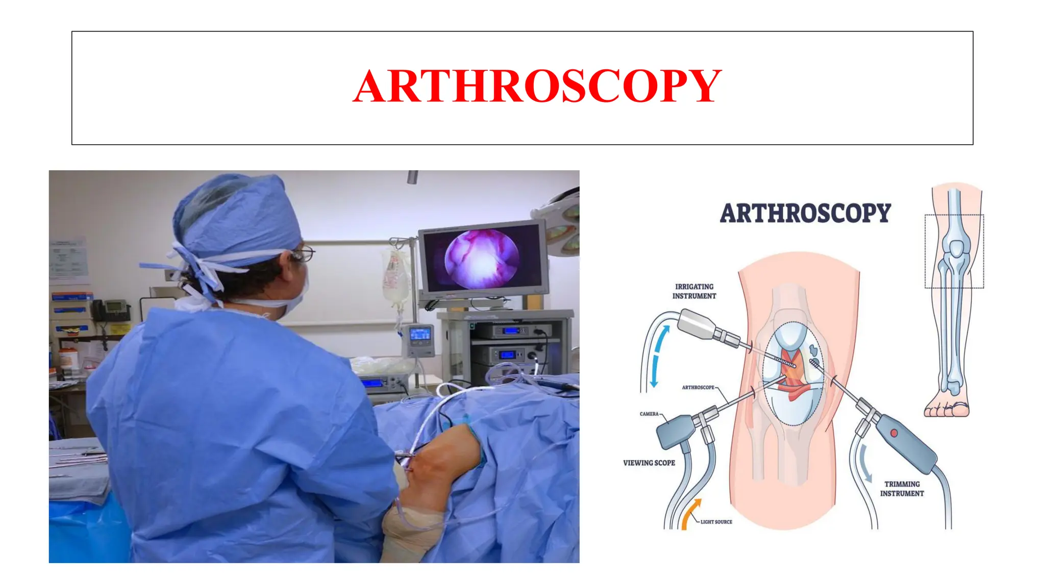 SURGICAL MANAGEMENT OF MUSCULO SKELETAL SYSTEM.pdf