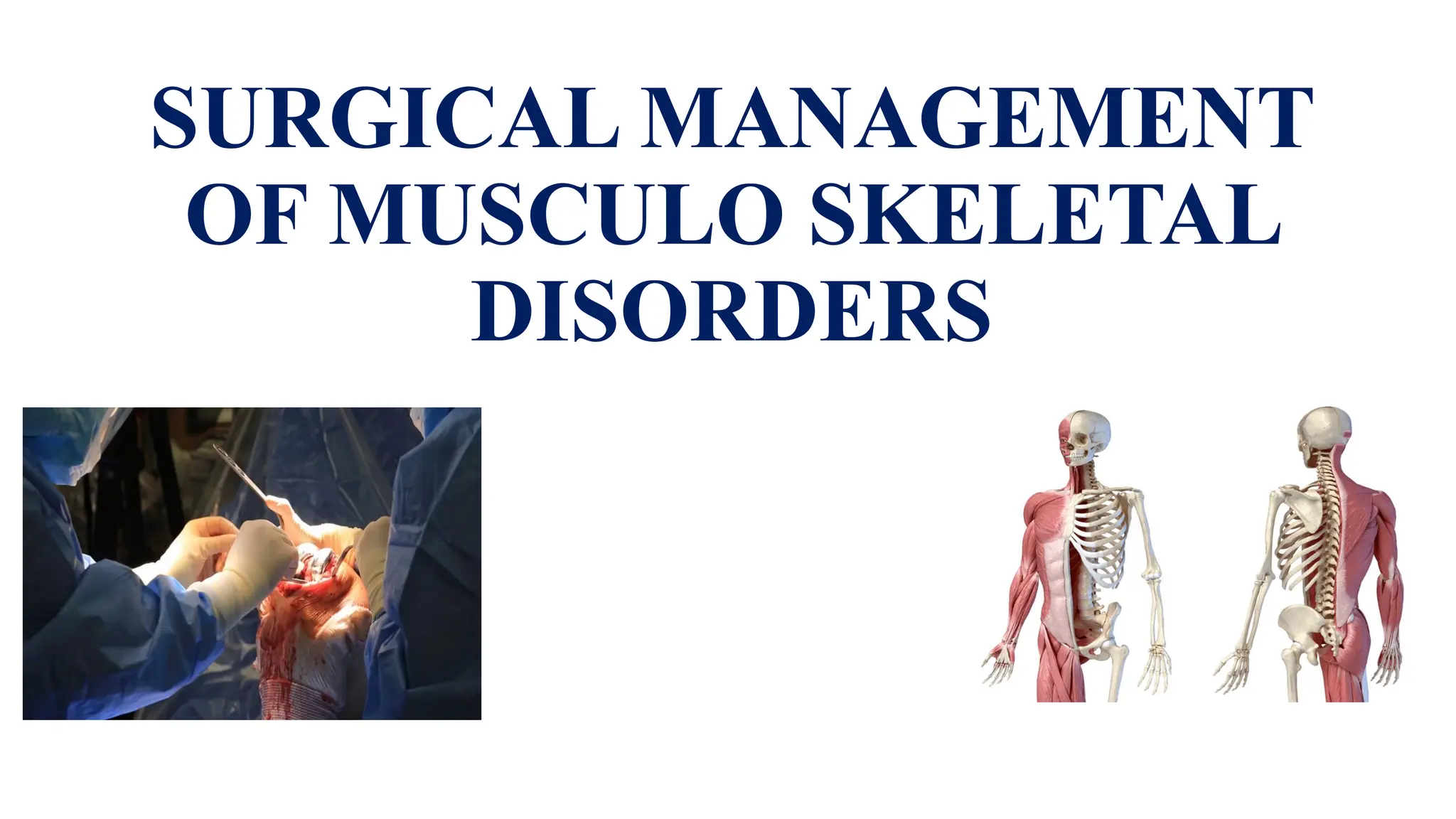 SURGICAL MANAGEMENT OF MUSCULO SKELETAL SYSTEM.pdf