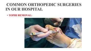 SURGICAL MANAGEMENT OF MUSCULO SKELETAL SYSTEM.pdf