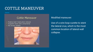 Surgical Management of Nasal Valve Insufficiency .pptx