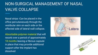 Surgical Management of Nasal Valve Insufficiency .pptx