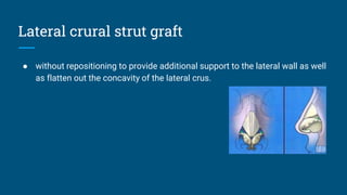 Surgical Management of Nasal Valve Insufficiency .pptx