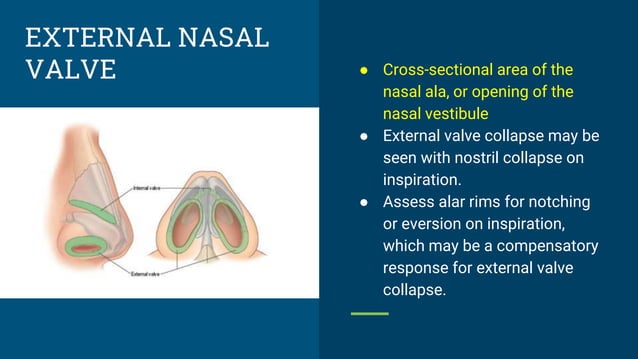 Surgical Management of Nasal Valve Insufficiency .pptx | Ear, Nose and ...